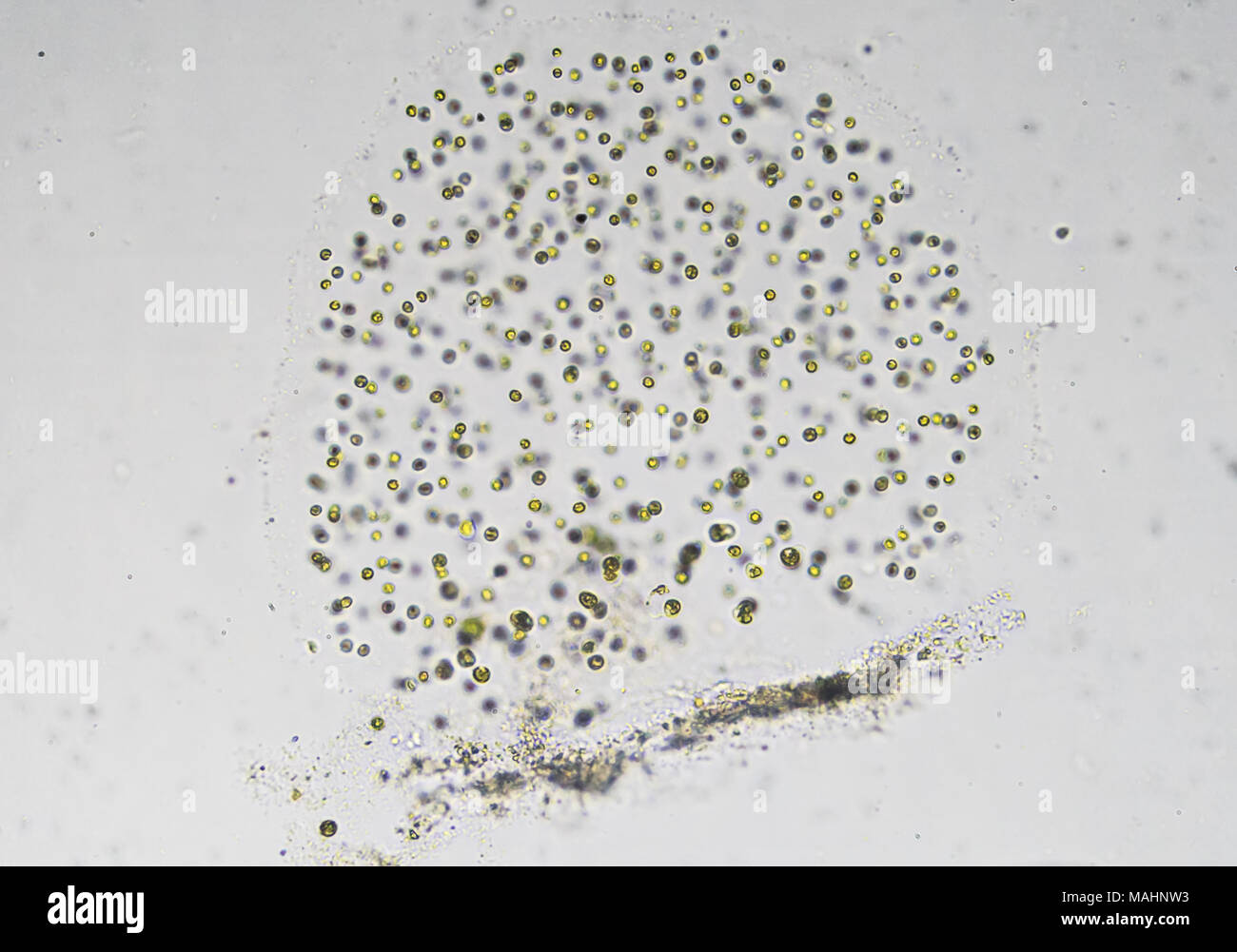 Microscope bacteria growth hi-res stock photography and images - Alamy