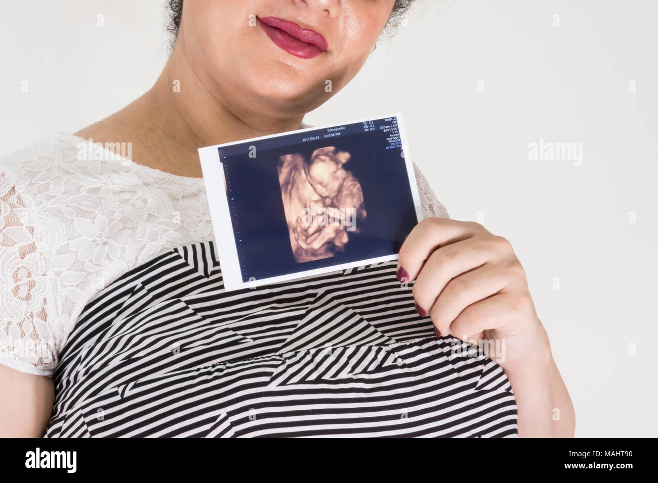 Left the fetus hi-res stock photography and images - Alamy