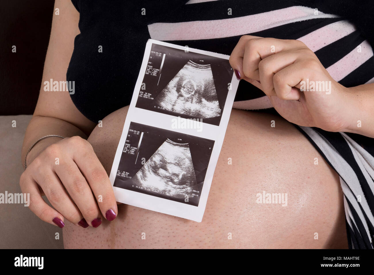 Baby x ray hi-res stock photography and images - Alamy