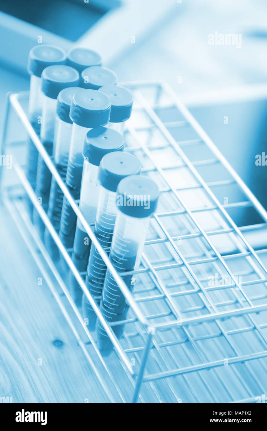 Vacutainer tube hi-res stock photography and images - Alamy