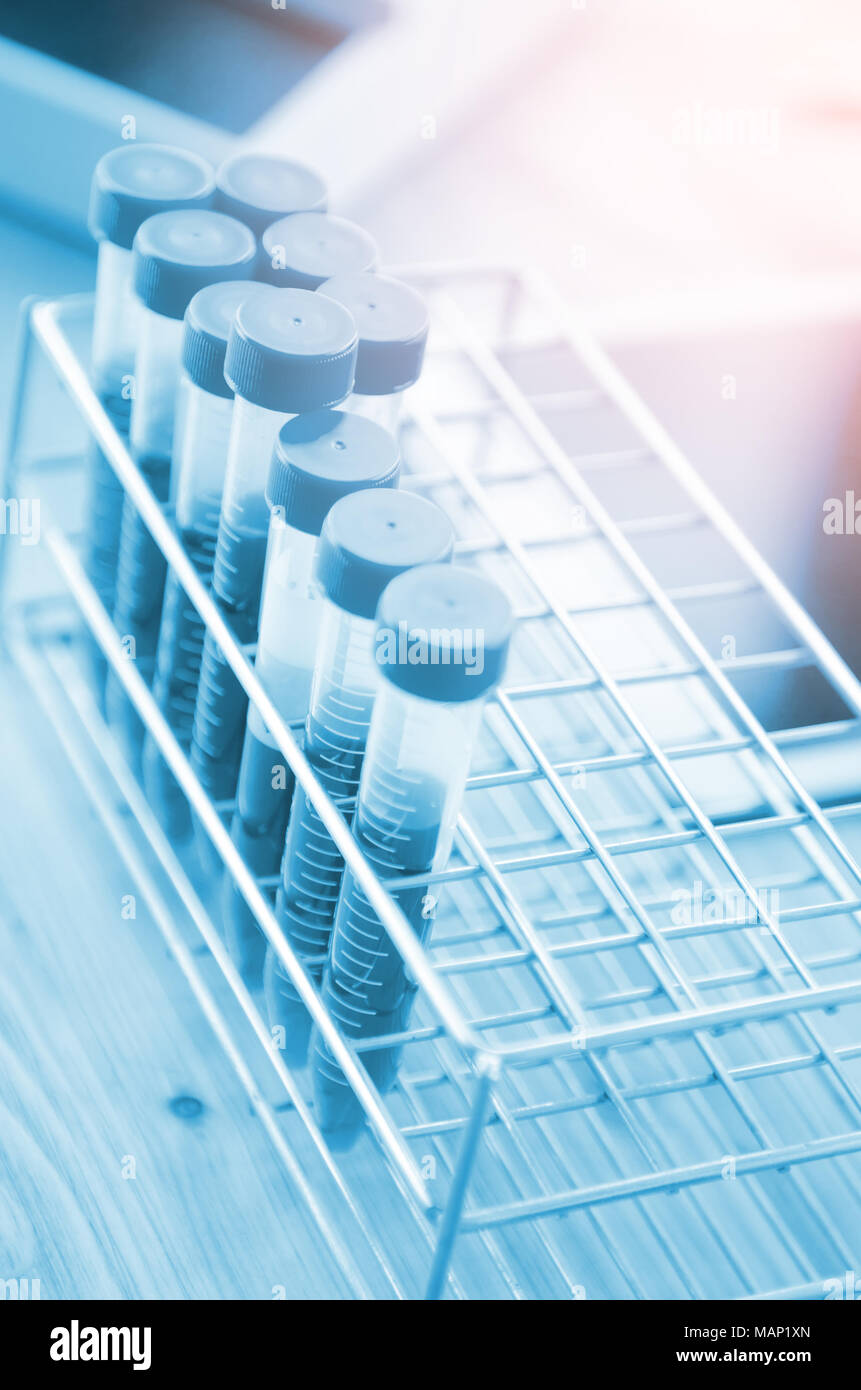 Vacutainer or test tube in lab on table Stock Photo - Alamy