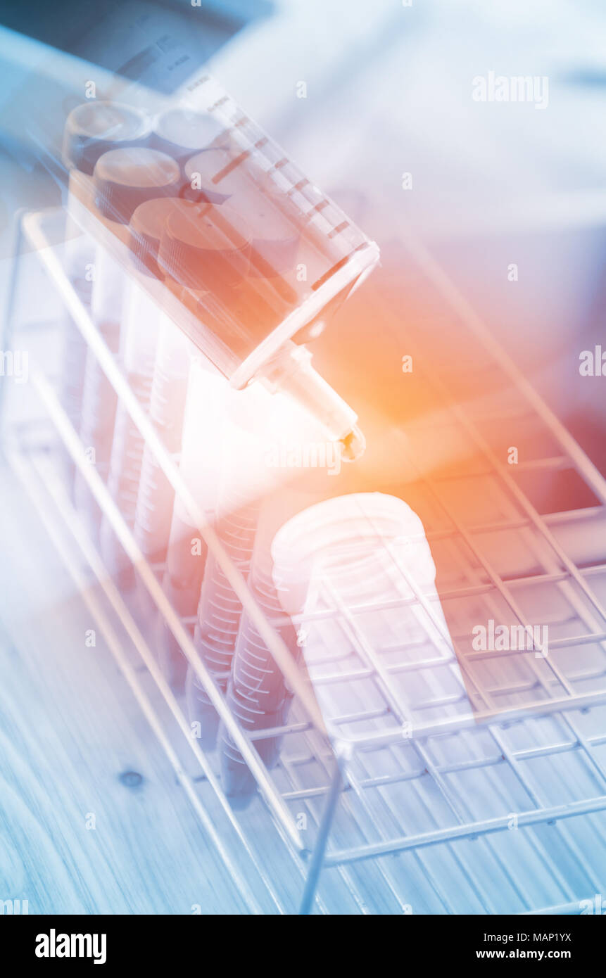 Vacutainer or test tube in lab on table Stock Photo - Alamy