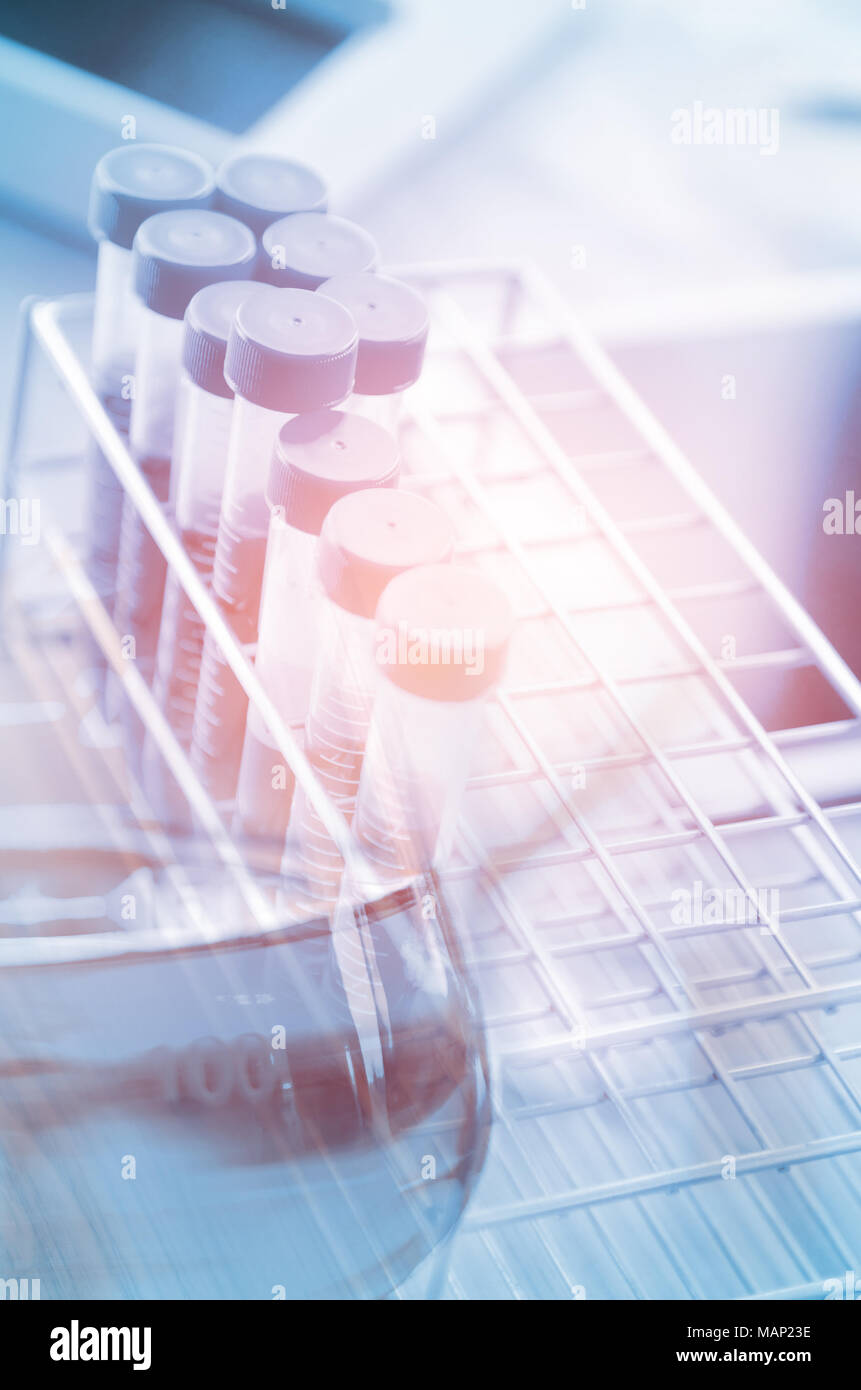 Vacutainer or test tube in lab on table Stock Photo - Alamy