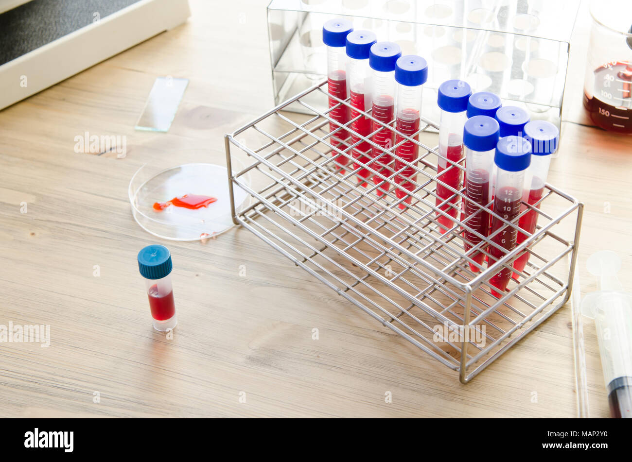 Vacutainer or test tube in lab on table Stock Photo - Alamy