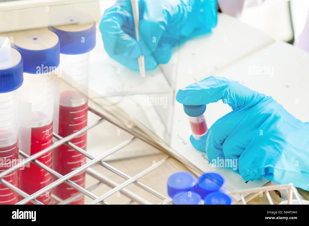 Vacutainer or test tube in lab on table and memory on report Stock ...