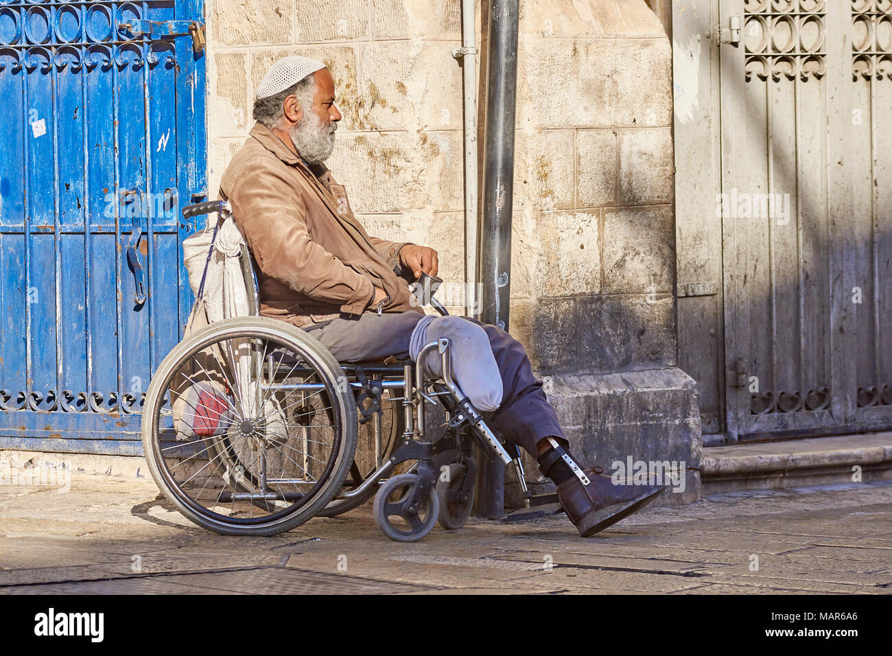 One Legged Amputee Old Man