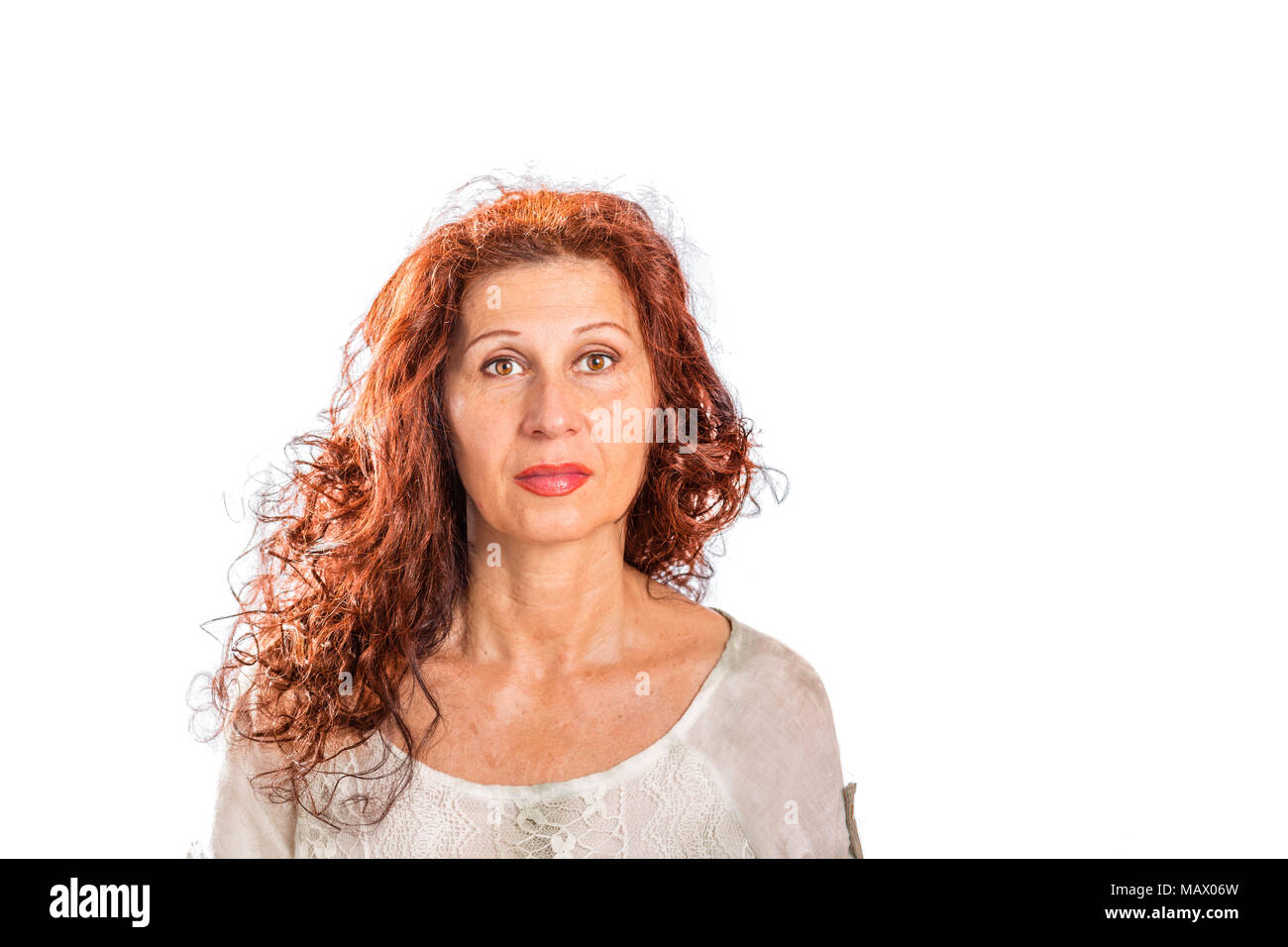 Aging defects in the skin of an elderly woman Stock Photo - Alamy