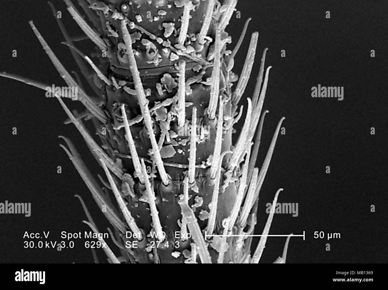 Colored scanning electron micrograph hi-res stock photography and ...