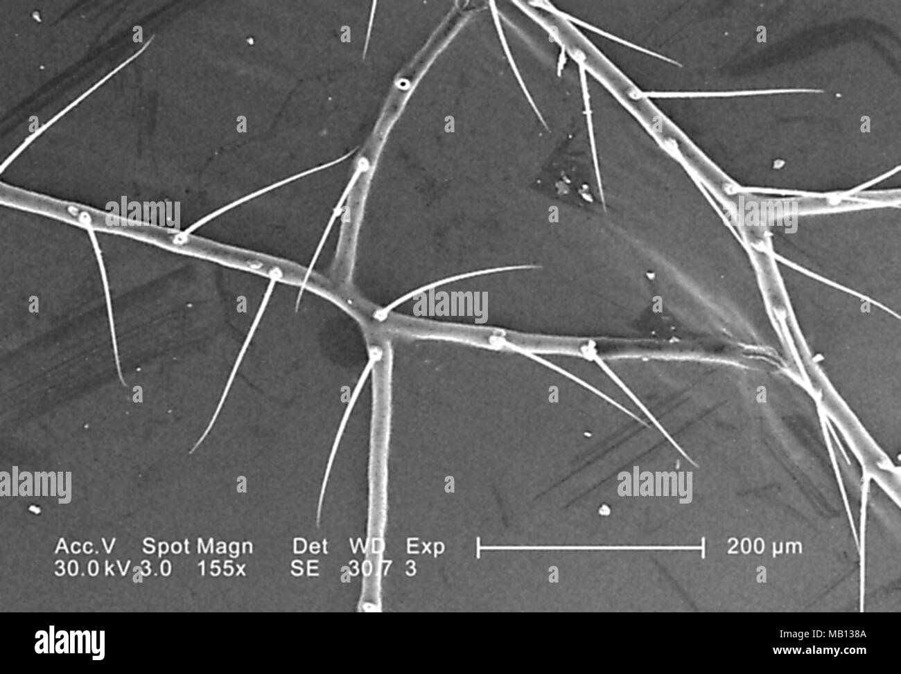 Colored scanning electron micrograph hi-res stock photography and ...
