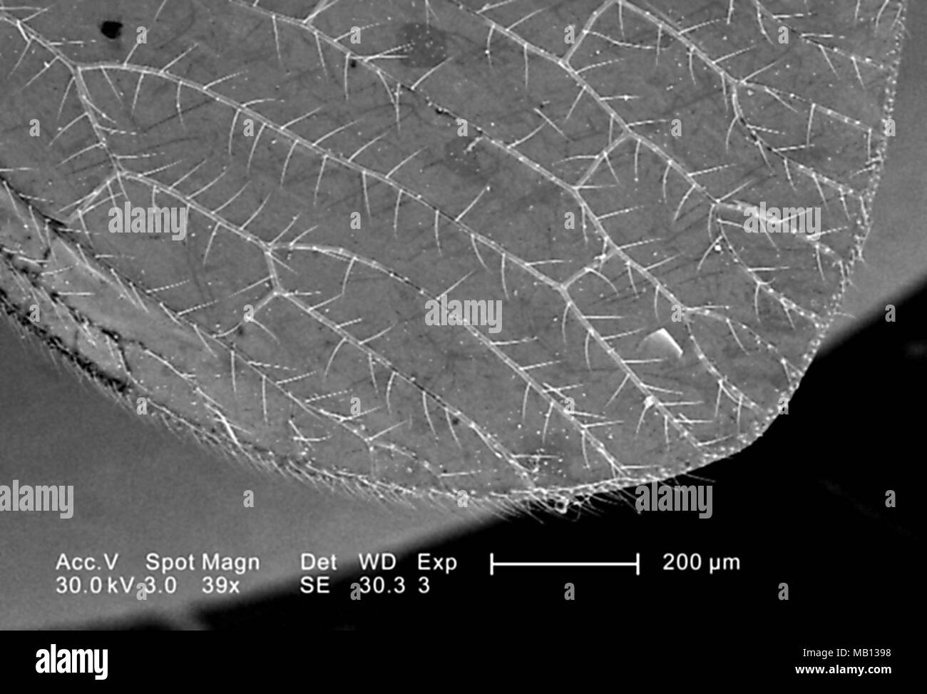 Colored scanning electron micrograph hi-res stock photography and ...