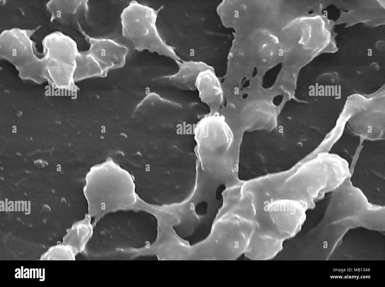Staphylococcus aureus bacteria on the luminal surface of an indwelling ...