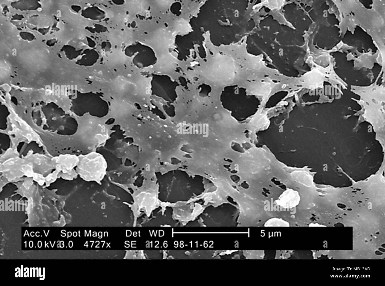Staphylococcus aureus bacteria on the luminal surface of an indwelling ...