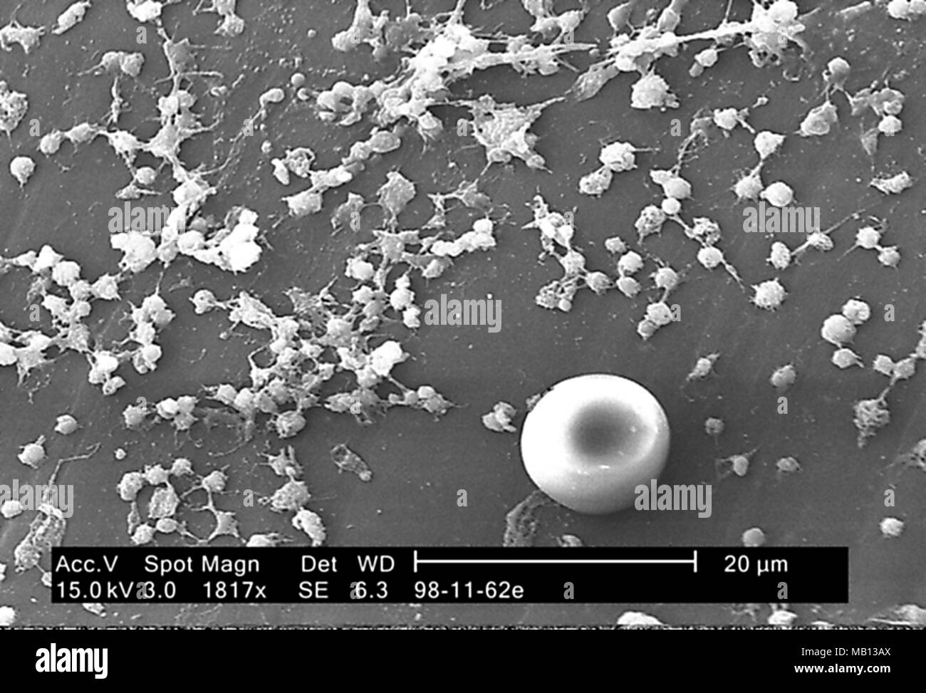 Staphylococcus aureus bacteria on the luminal surface of an indwelling ...