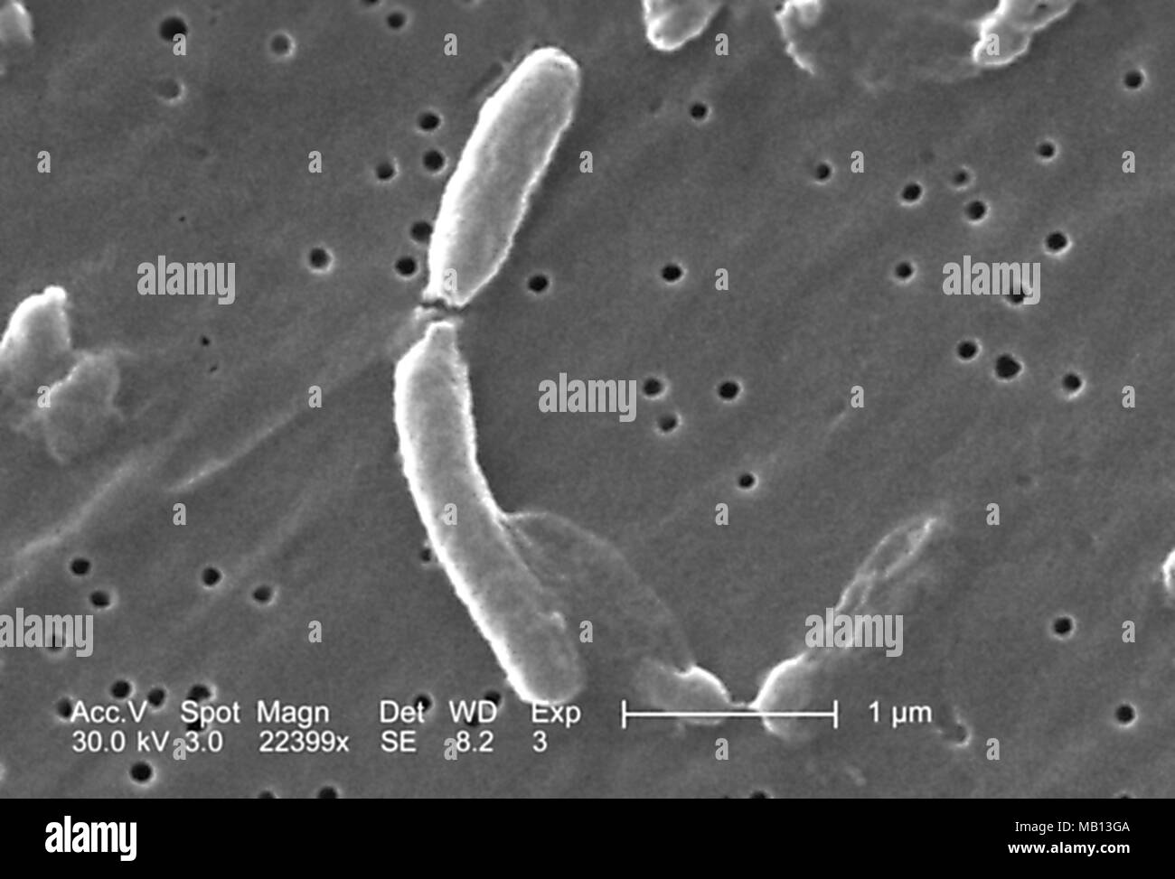 Vibrio cholerae bacterium hi-res stock photography and images - Alamy
