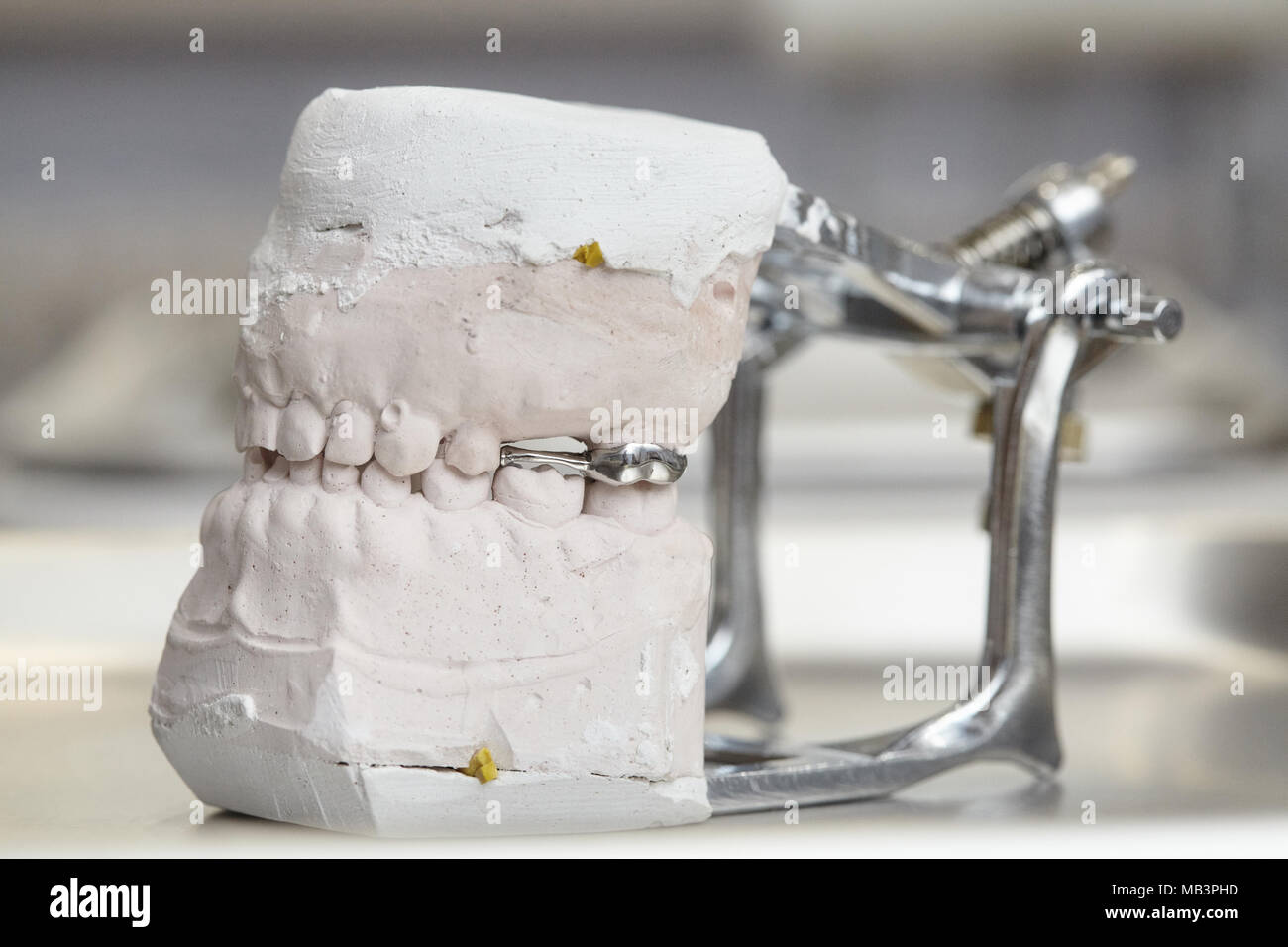 Gray dental prosthesis teeth mold, clay human gums model in jaws ...