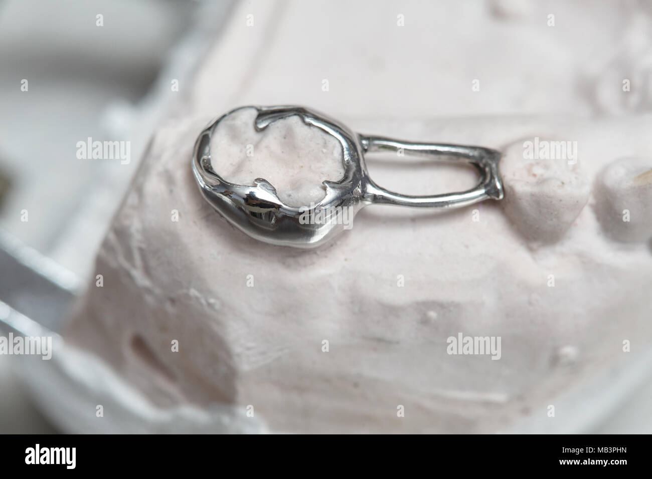 Gray dental prosthesis teeth mold, clay human gums model in jaws ...