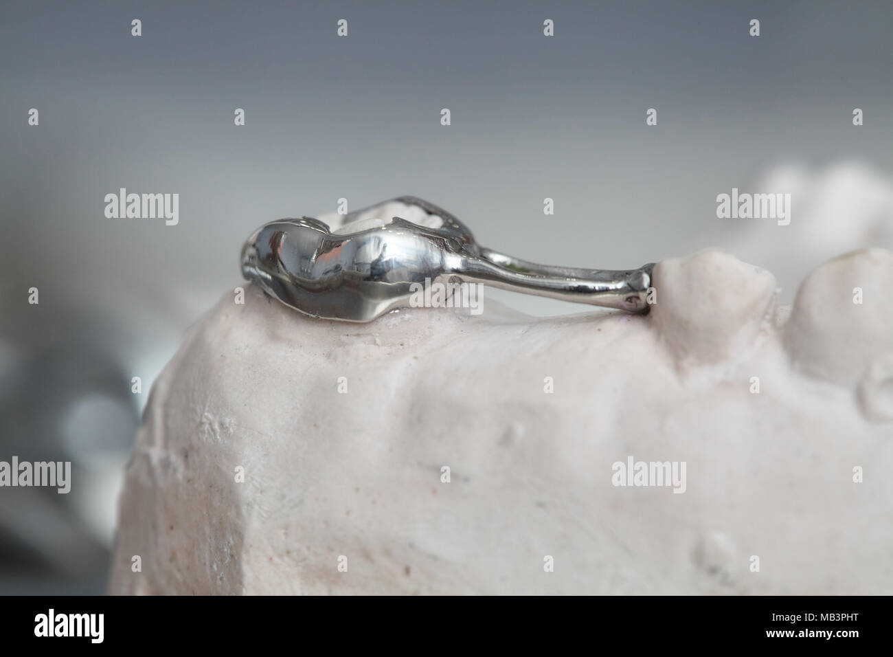 Gray dental prosthesis teeth mold, clay human gums model in jaws ...