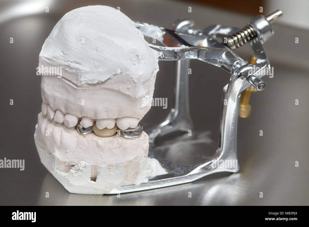 Gray dental prosthesis teeth mold, clay human gums model in jaws ...