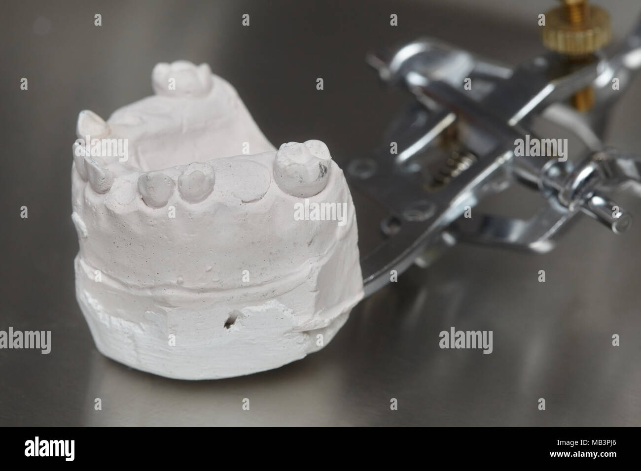 Gray dental prosthesis teeth mold, clay human gums model in jaws ...