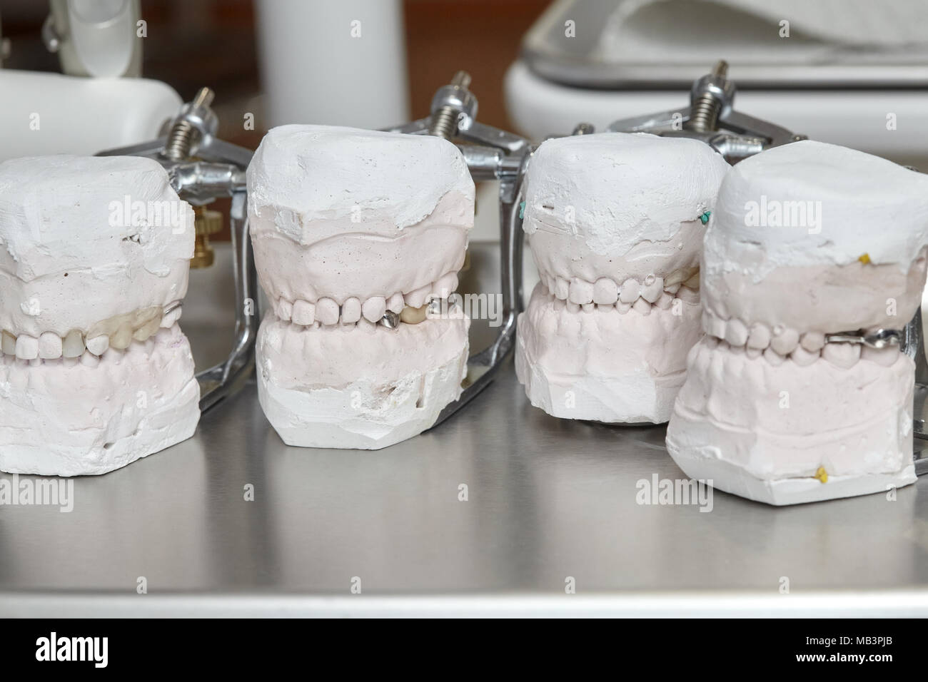 Gray dental prosthesis teeth mold, clay human gums model in jaws ...