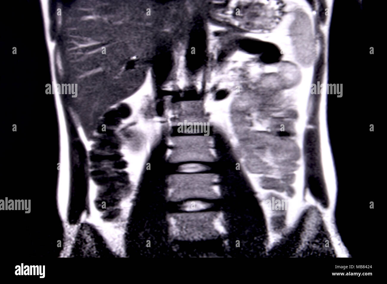 Ride through the human abdomen and chest by means of 18 MRI cuts ...