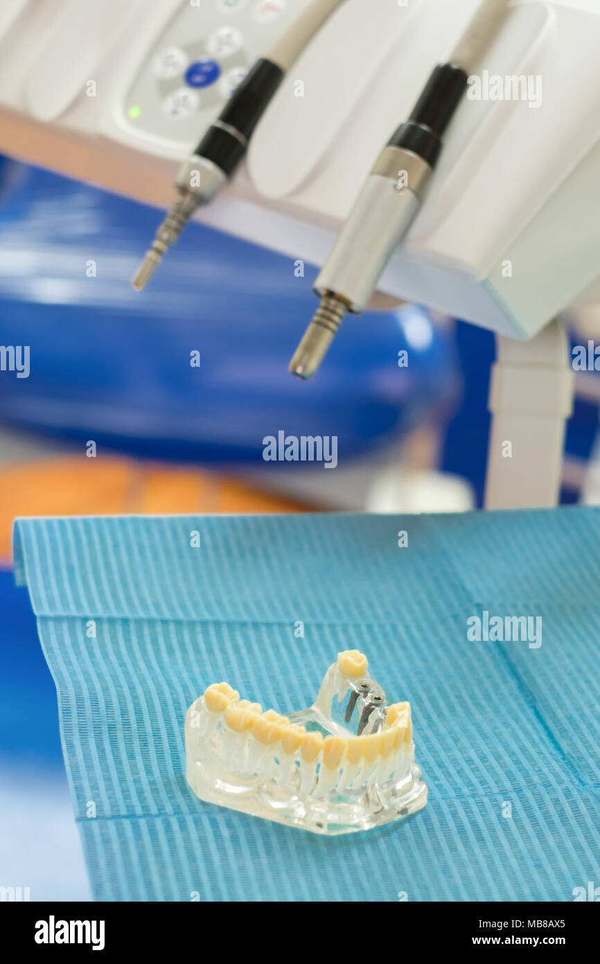 Denture fitting replacement isolated in dentist clinic Stock Photo - Alamy