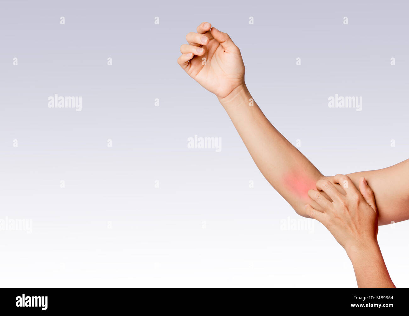 Scratching Arm Stock Photos & Scratching Arm Stock Images - Alamy