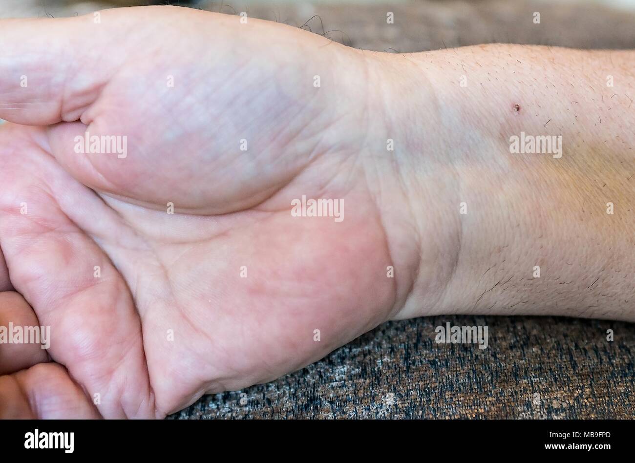 Coronary stent hand hi-res stock photography and images - Alamy