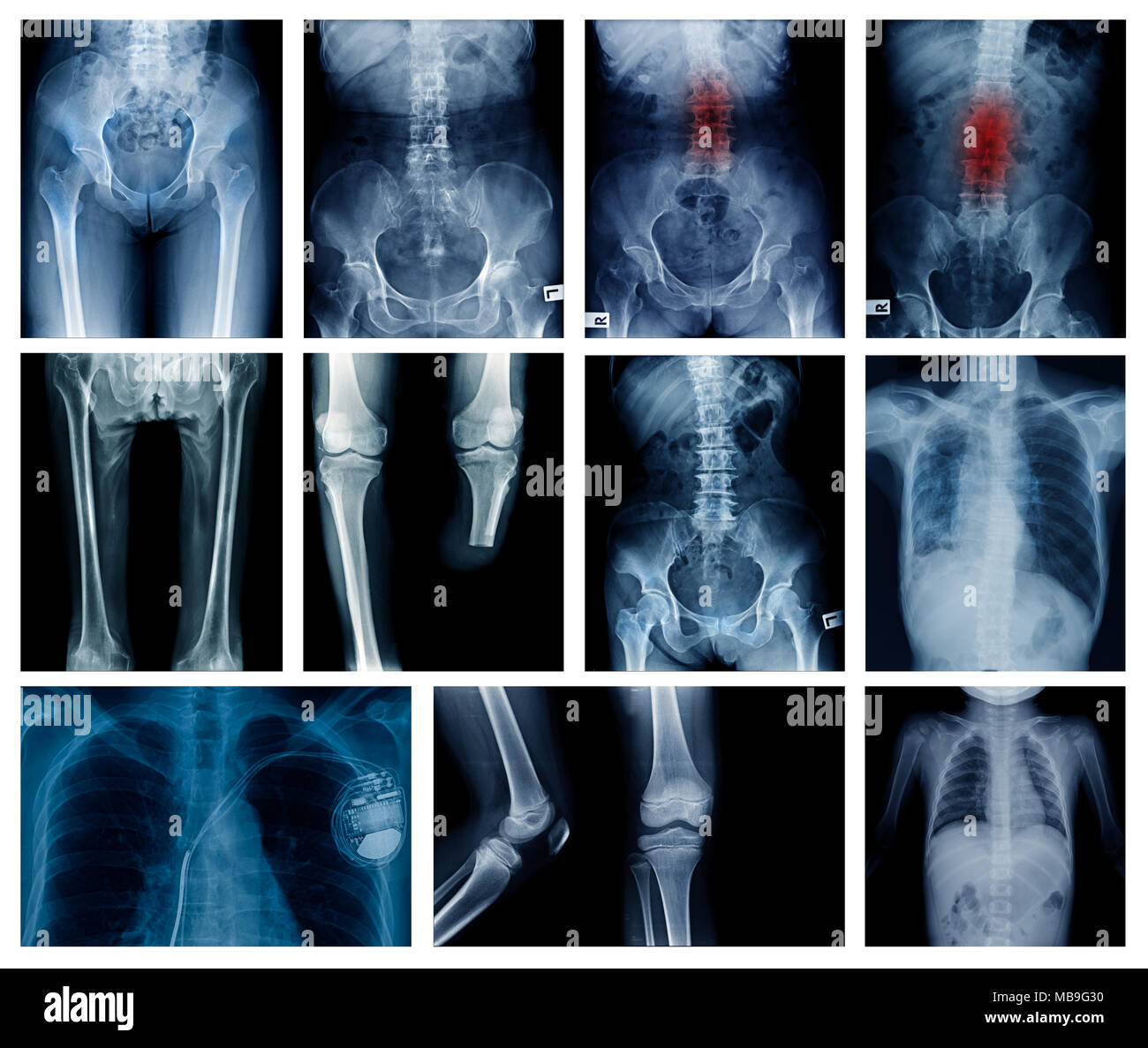 High quality collection x-ray image show many body part of human Stock ...