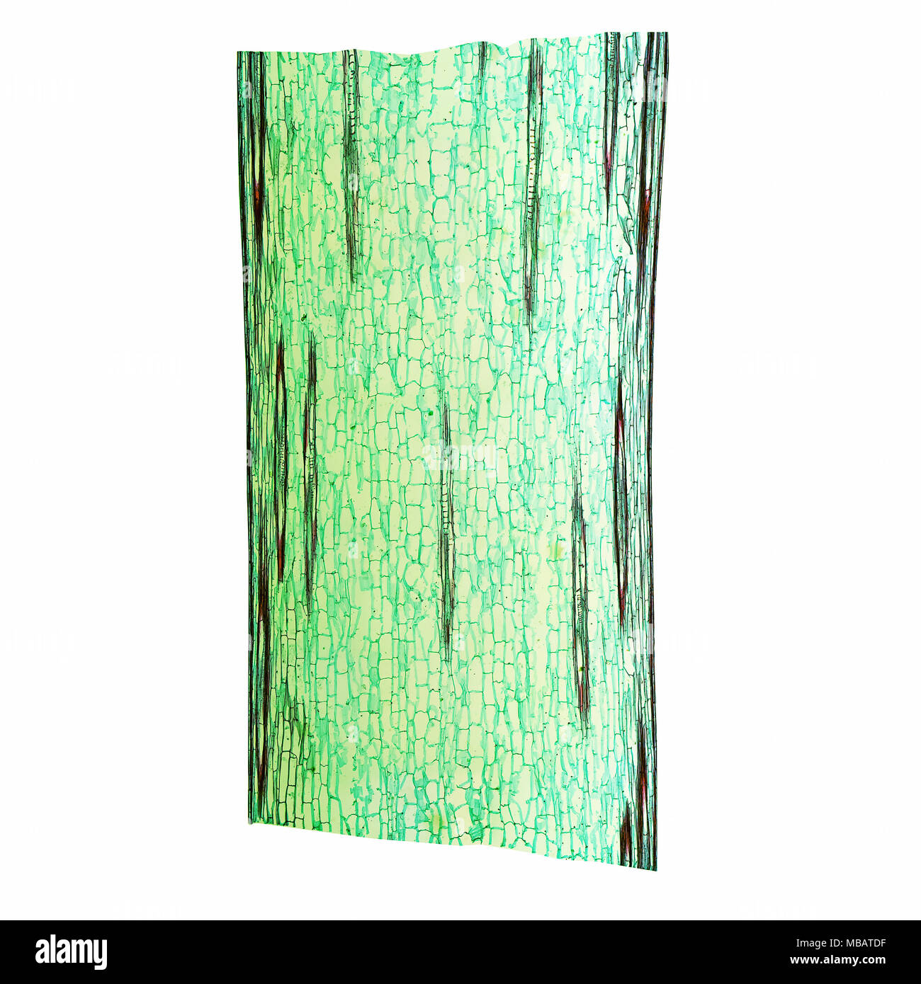 Light photomicrograph of Corn stem longitudinal section seen through ...