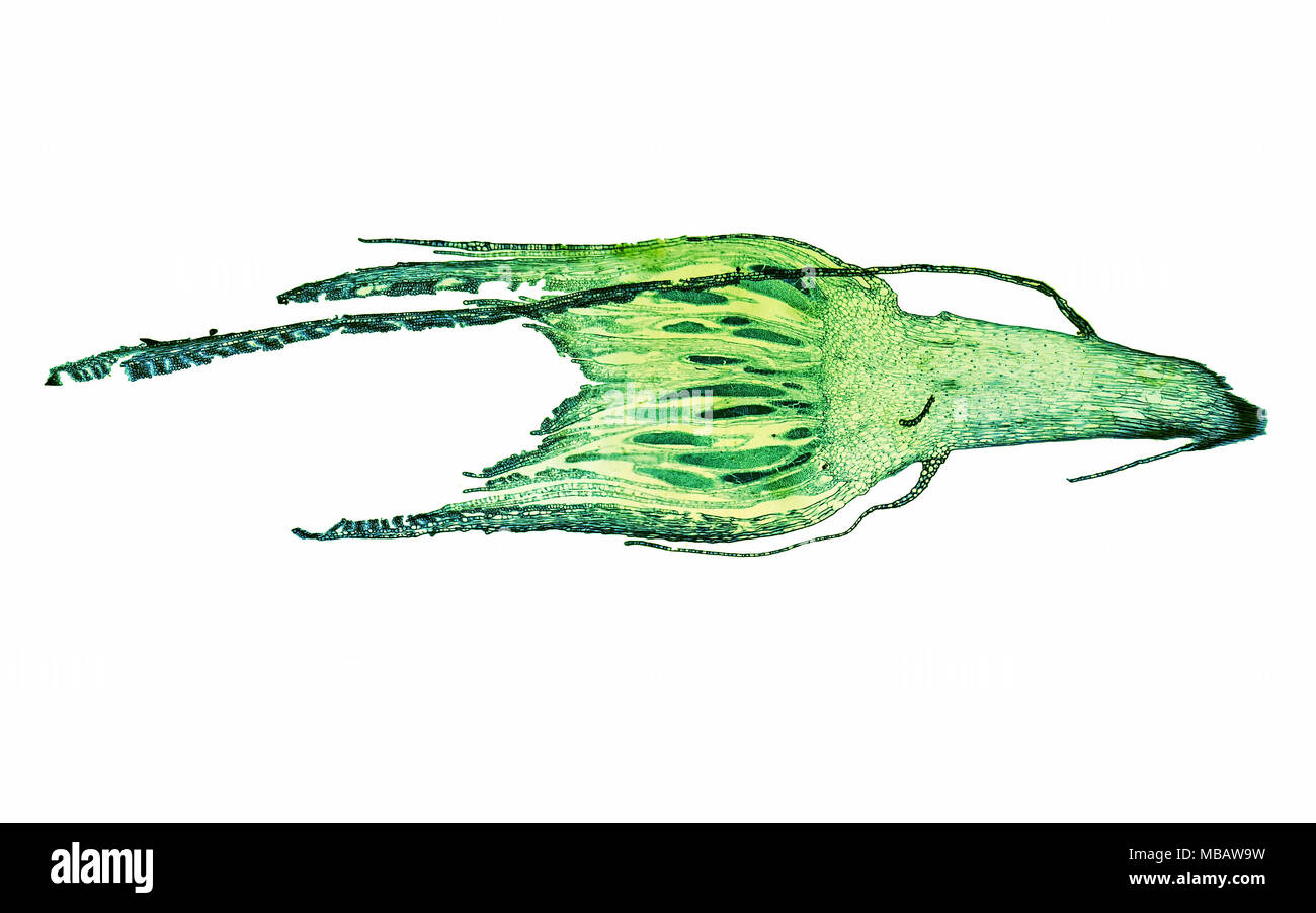 Light photomicrograph of Moss protonemata whole mount seen through ...