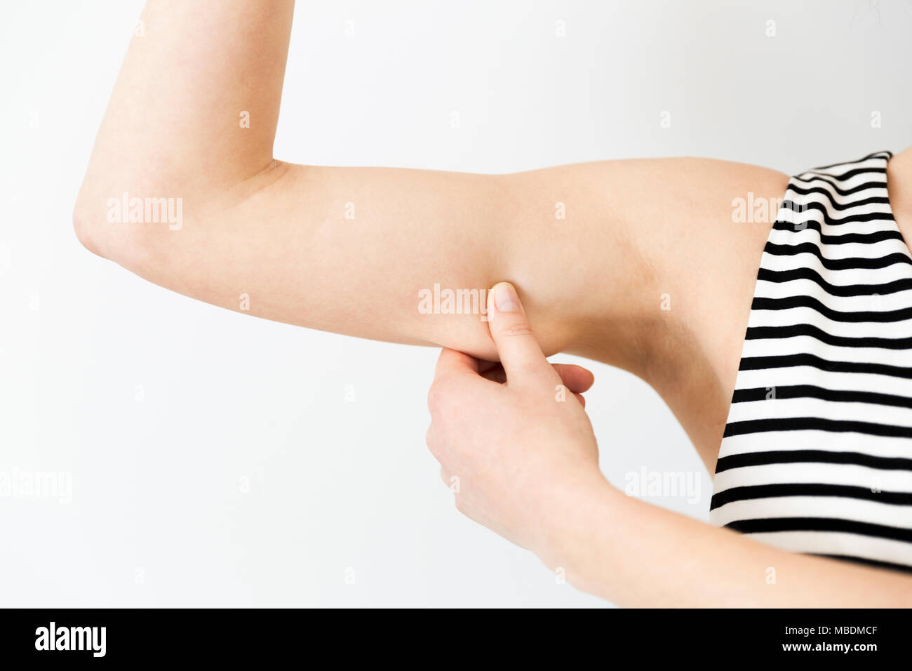 Upper arm surgery hi-res stock photography and images - Alamy