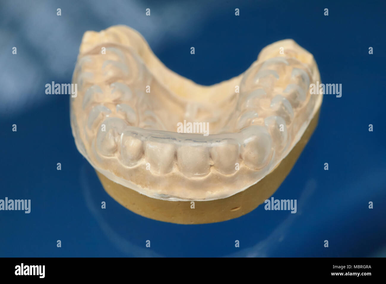 Dental prosthesis teeth mold, clay human gums model in jaws prothetic ...