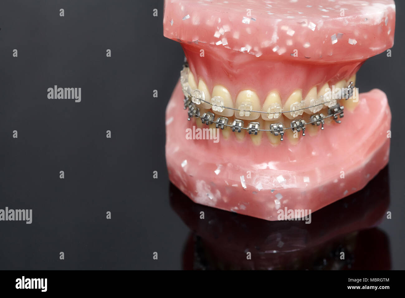Wired braces hi-res stock photography and images - Alamy