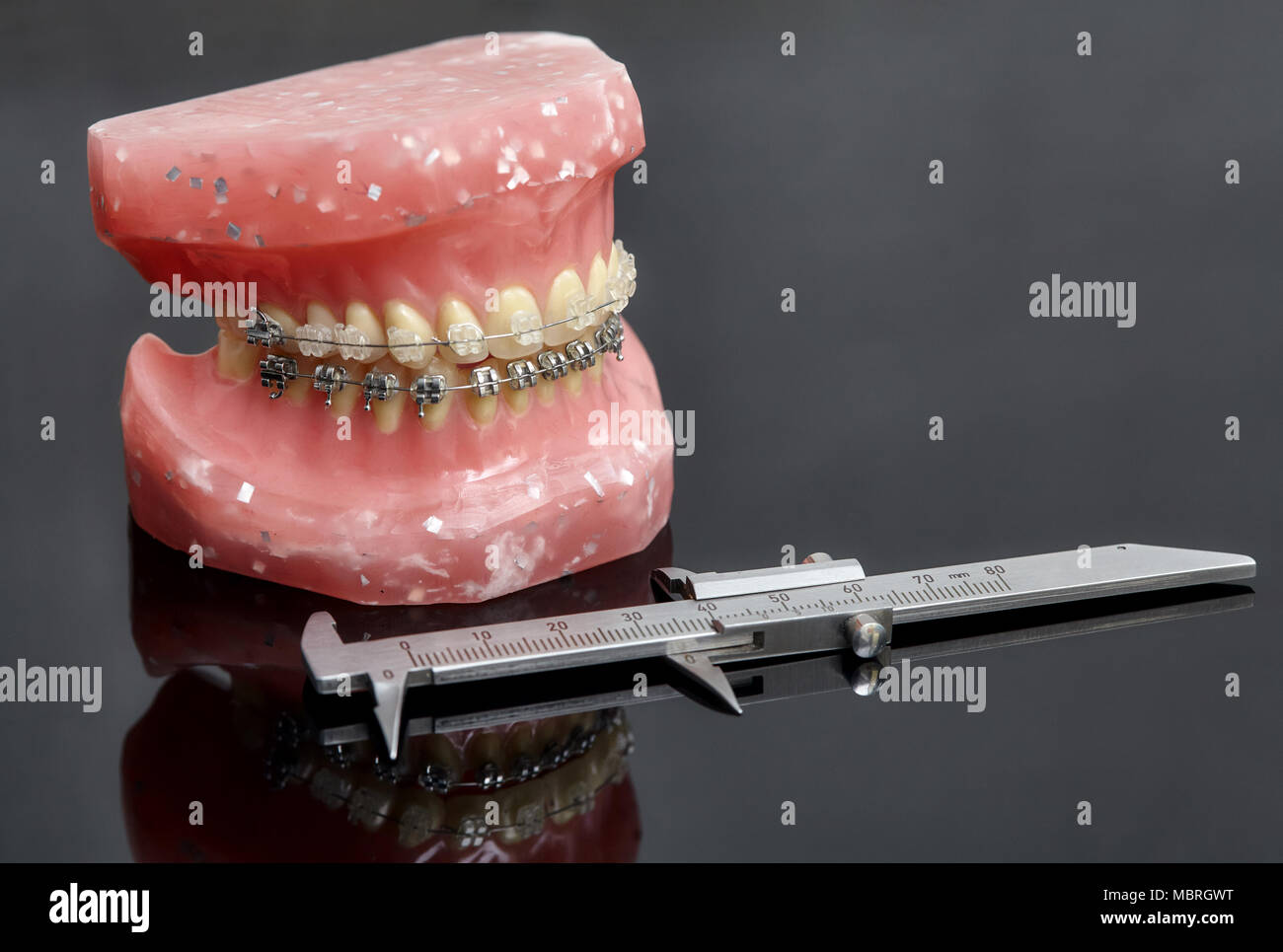 Human jaw or teeth model with metal wired dental braces and vernier ...