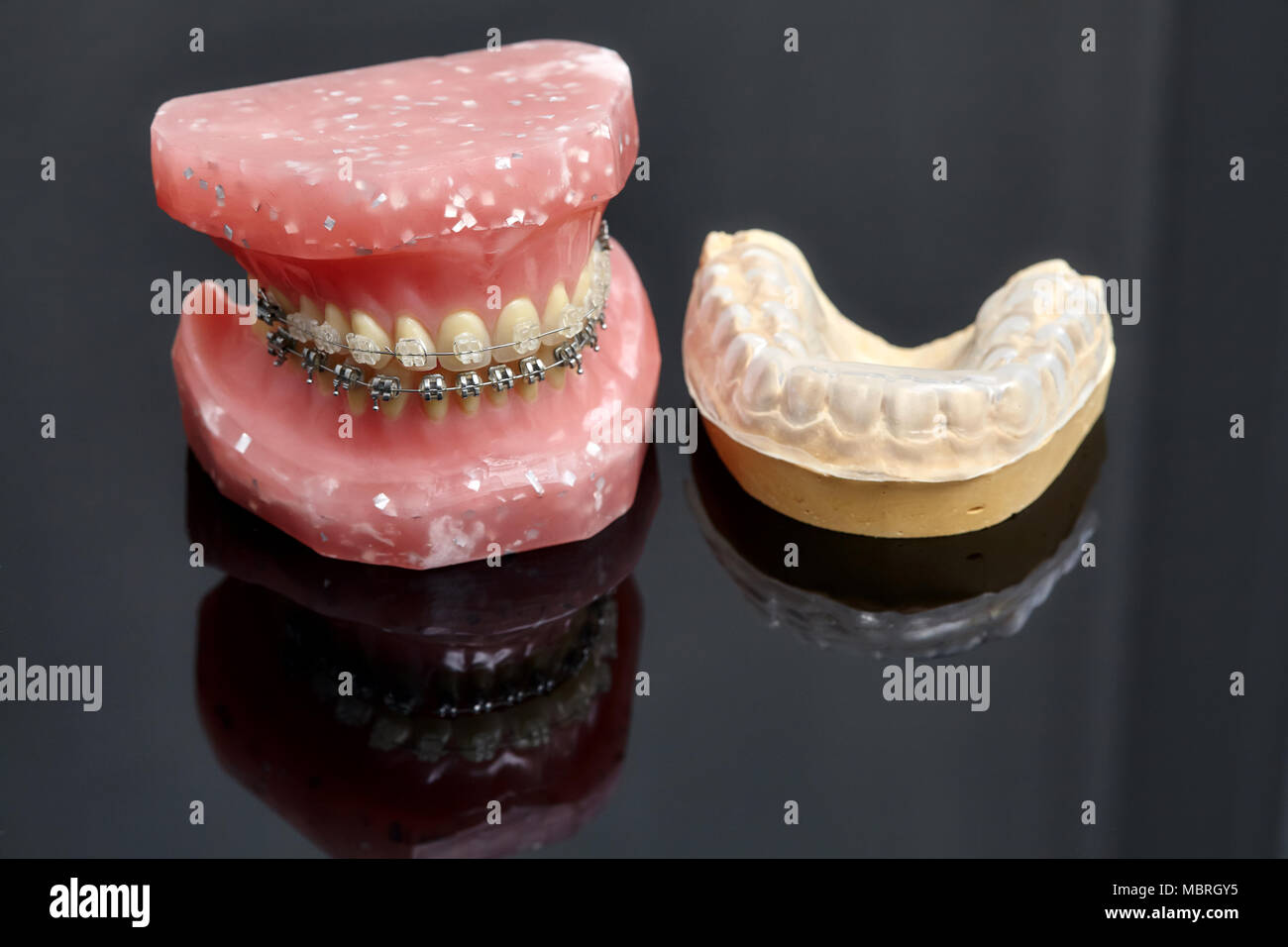 Wired teeth hi-res stock photography and images - Alamy
