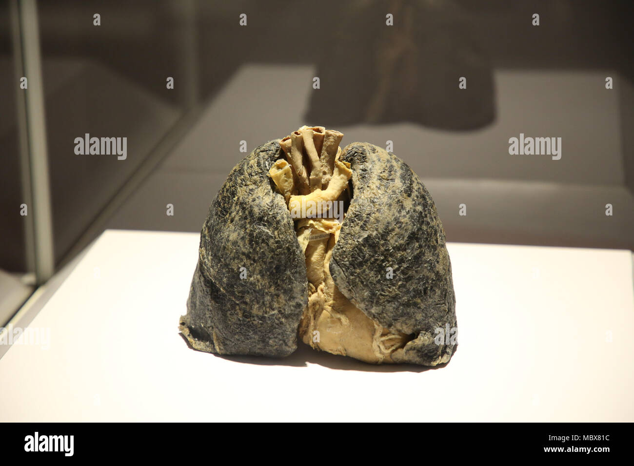 Real Respiratory System