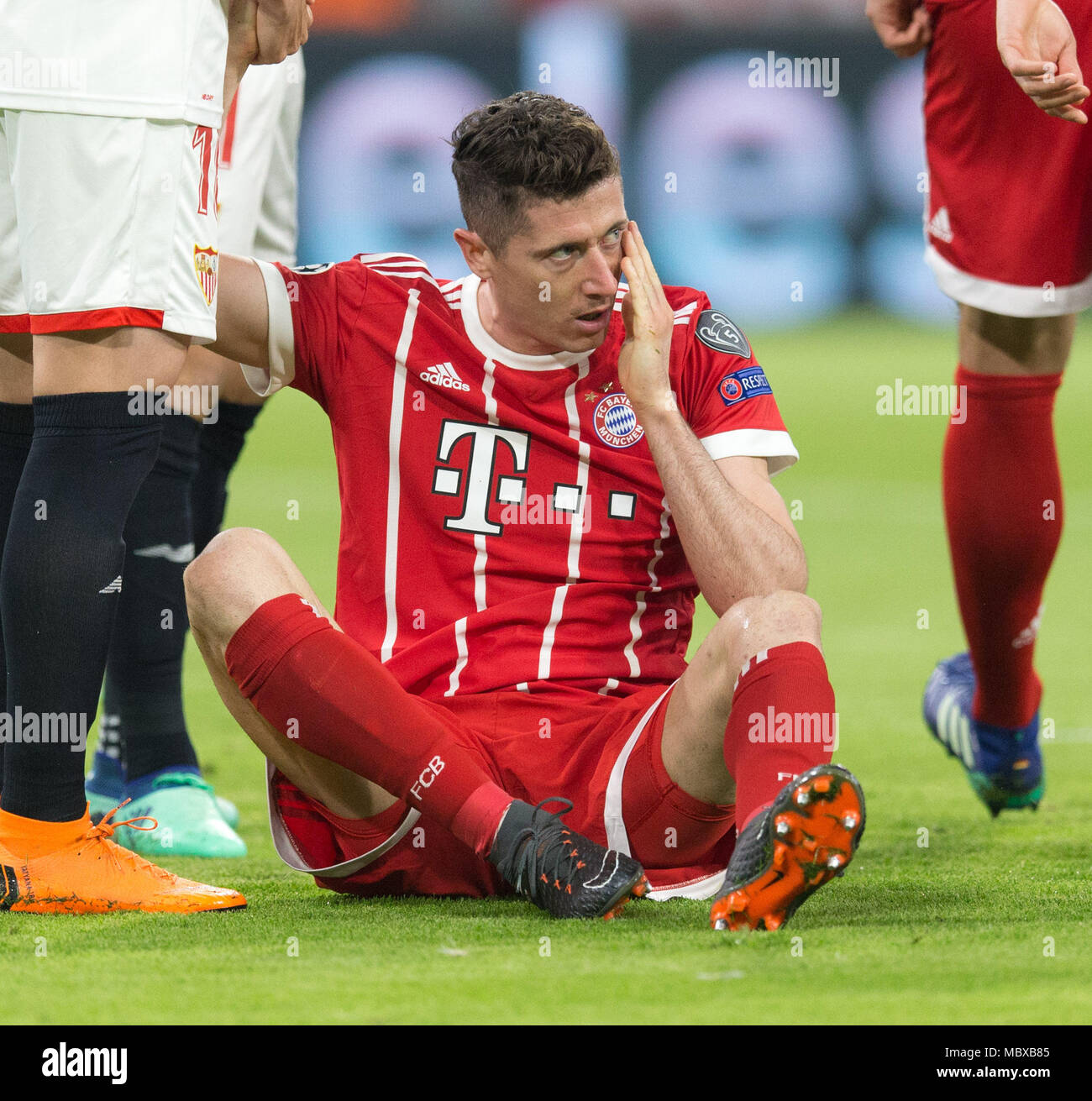 Robert LEWANDOWSKI (FC Bayern) with Beule am Auge GES/ Fussball ...