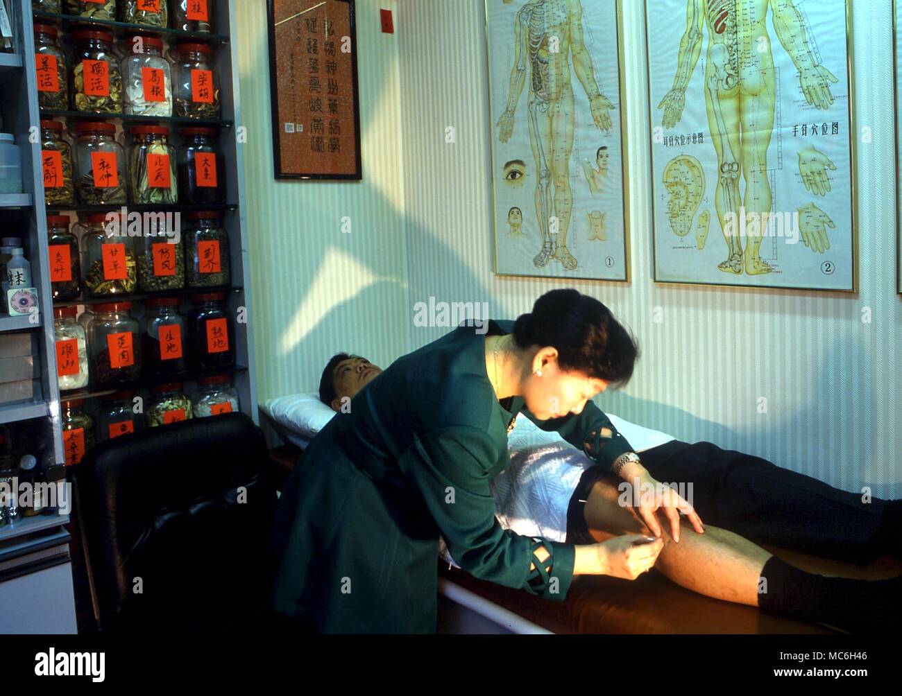 Acupuncture. A Chinese acupuncture man, with the main subtle lines ...