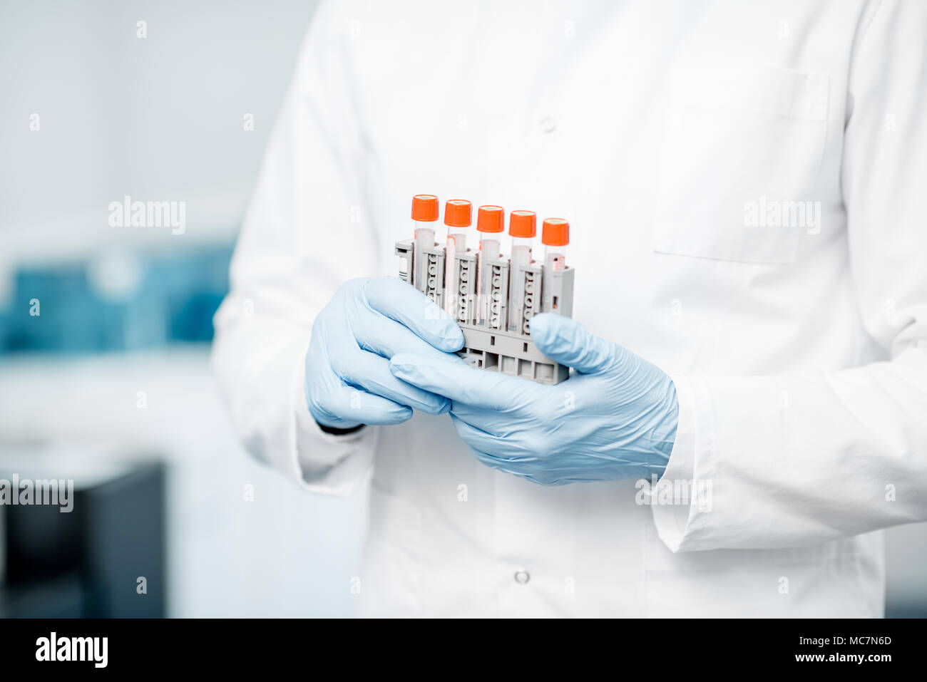 Laboratory assistant holding test tubes near the analyzer machine Stock ...