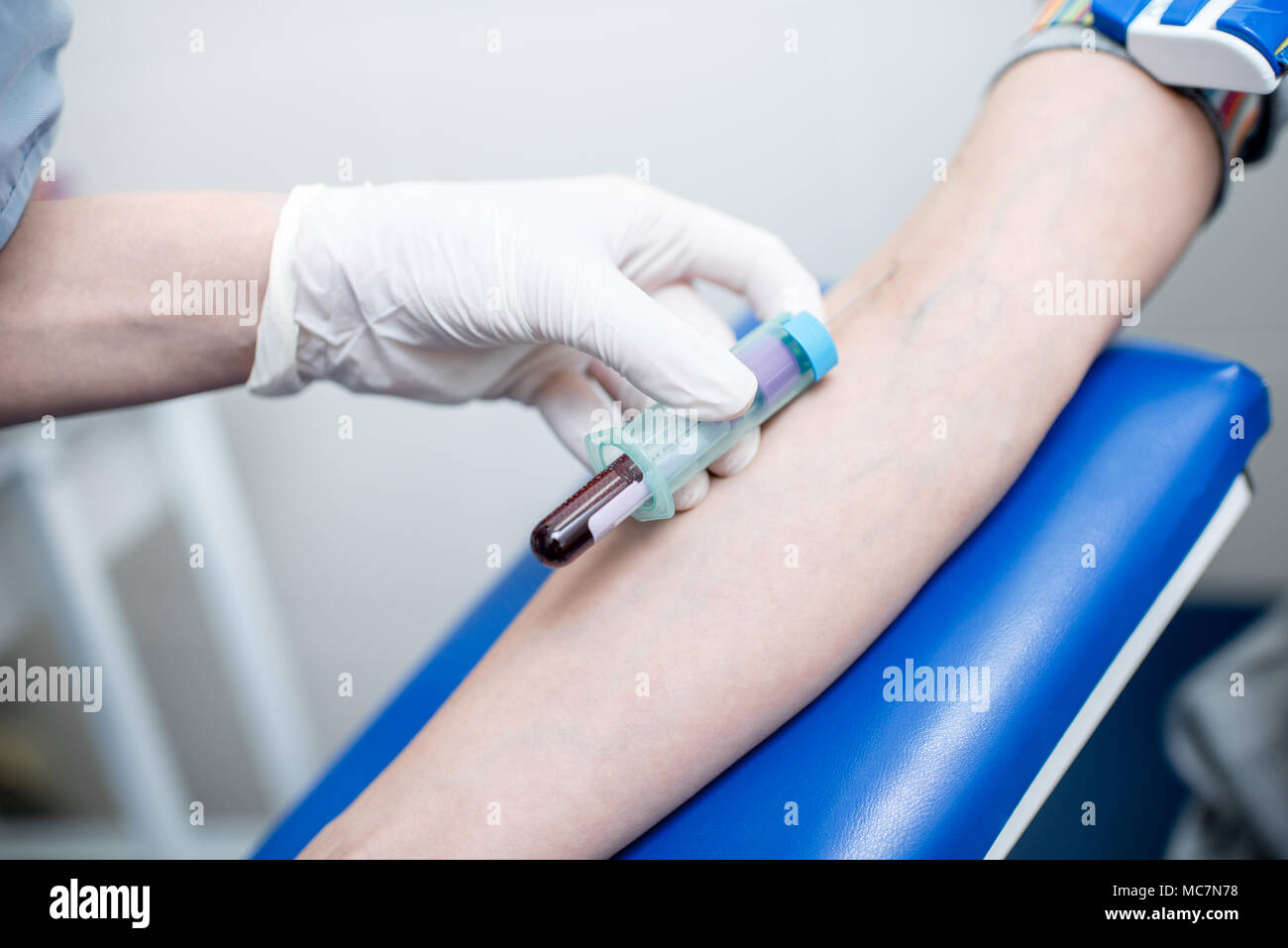 Laboratory assistant taking blood with vacuum capsule for test from the ...