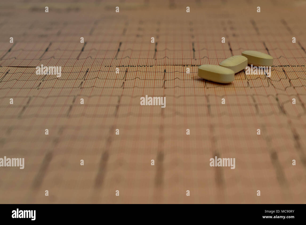 Normal sinus rhythm hi-res stock photography and images - Alamy