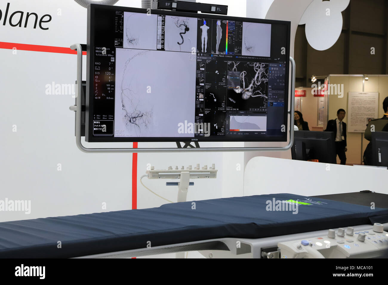 3d angiography hi-res stock photography and images - Alamy