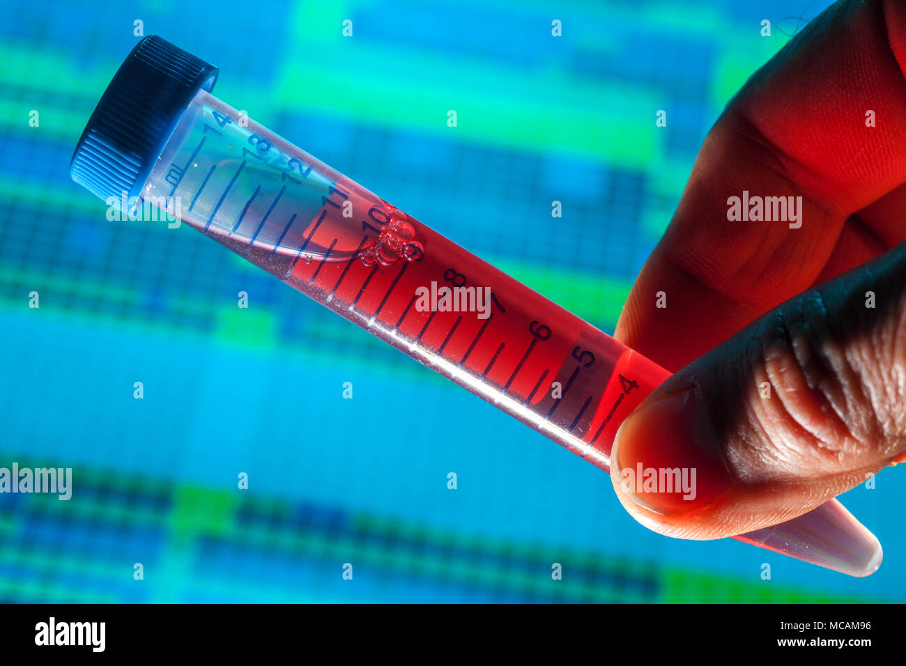 Bio samples for genetic analysis Blood In tube for laboratory analysis ...