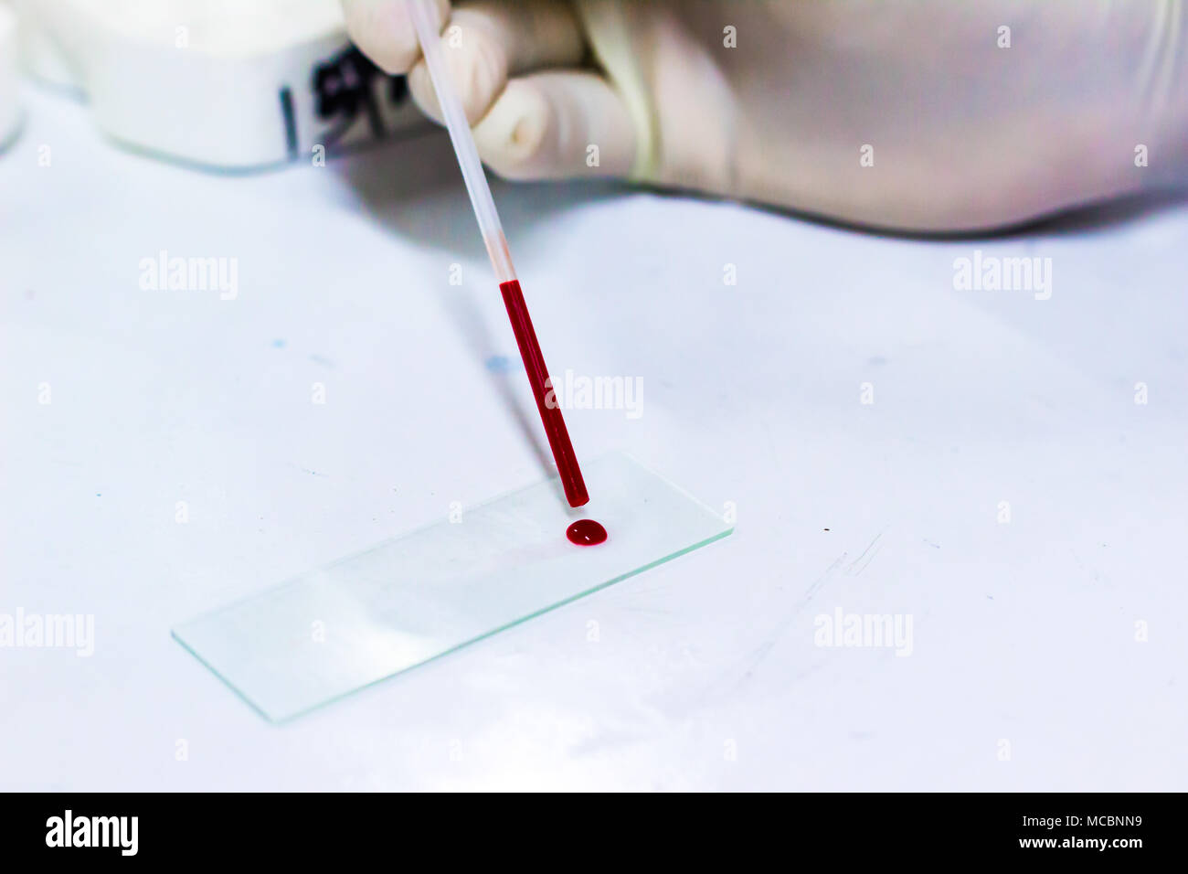 scientist dropping a drop of blood on a glass slide Stock Photo - Alamy
