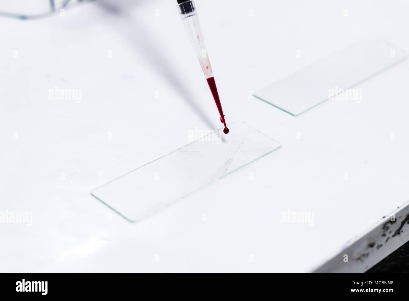 drop of blood on a glass slide using micropipette microtip Stock Photo ...
