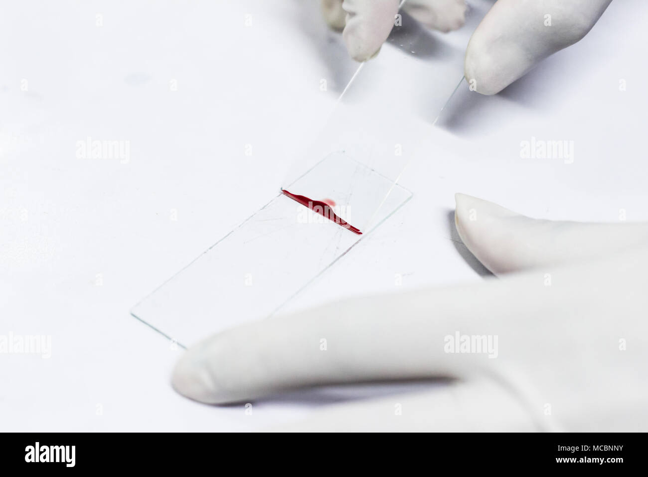 Blood cell drawing hi-res stock photography and images - Alamy