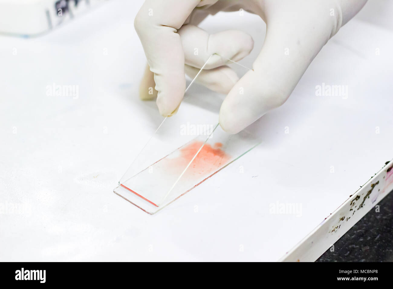 Blood Smear Stock Photos & Blood Smear Stock Images - Alamy