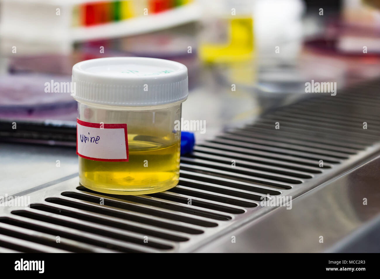 Urine sample in an asceptic container for laboratory pathological ...