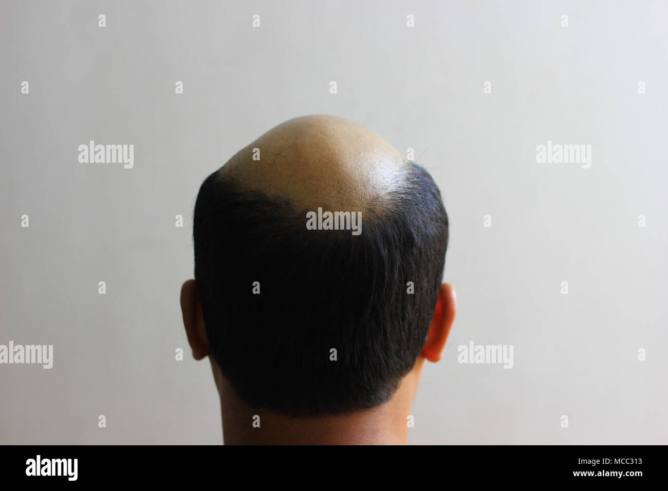 Bald head behind hi-res stock photography and images - Alamy